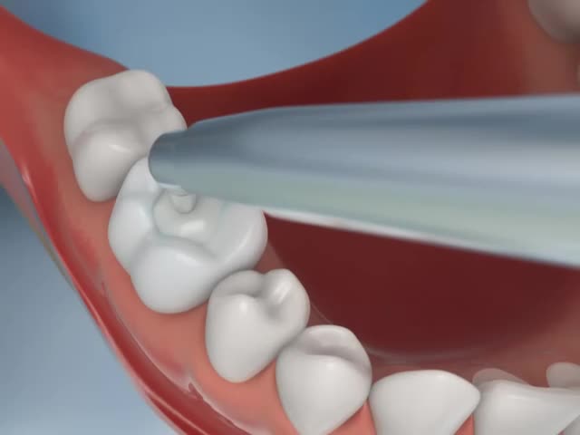 Create high quality 3d dental animation, medical 3d modeling and teeth ...