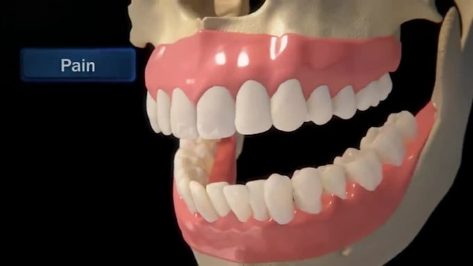 2d 3d medical animation anatomy scientific biomedical animation explainer video by Nicolemary ...