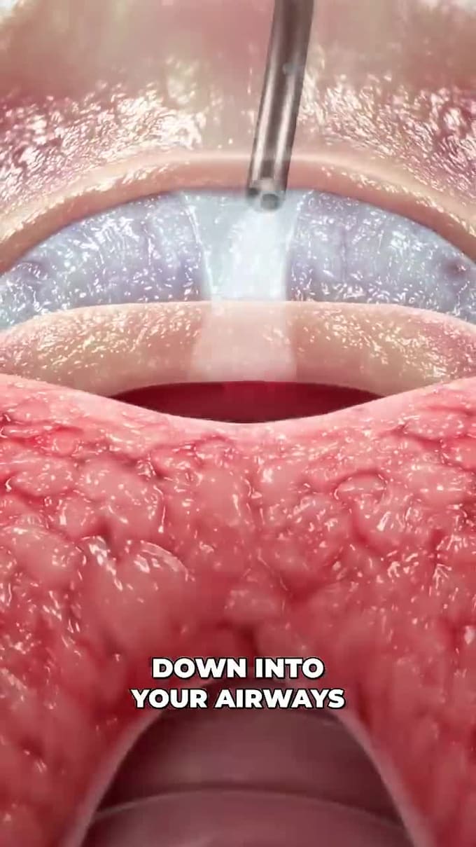 Do 3d animation,medical animation,medical 3d medical animation surgery ...