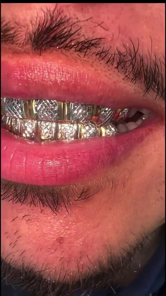 Design custom 3d grillz, tooth jewelry designs, and cards tailored to ...