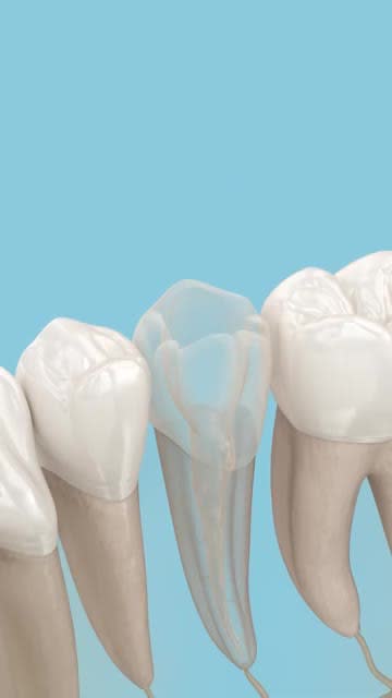 Create surgical animation, tele health animation, dental animation by ...