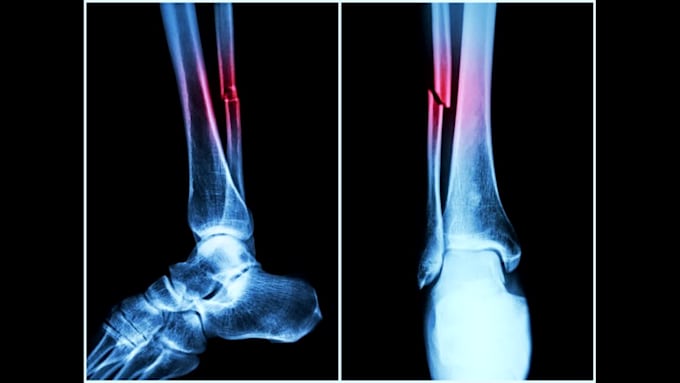 Make a bone cracking sound effect by Kazelsdrinks | Fiverr