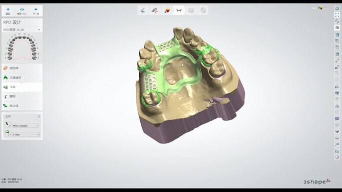 Design high quality dental crown bridge denture restorations in exocad ...