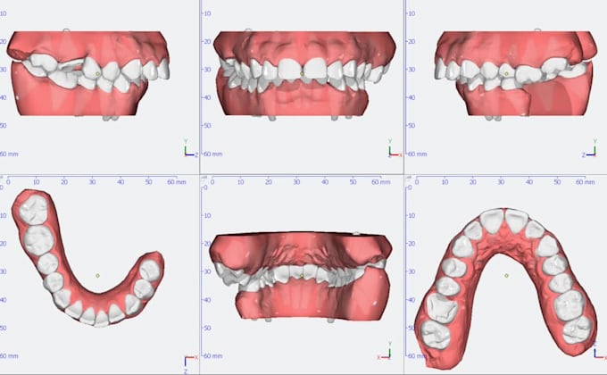 Prepare expert aligner plans, 3shape,onyxceph by Glossydentalx | Fiverr