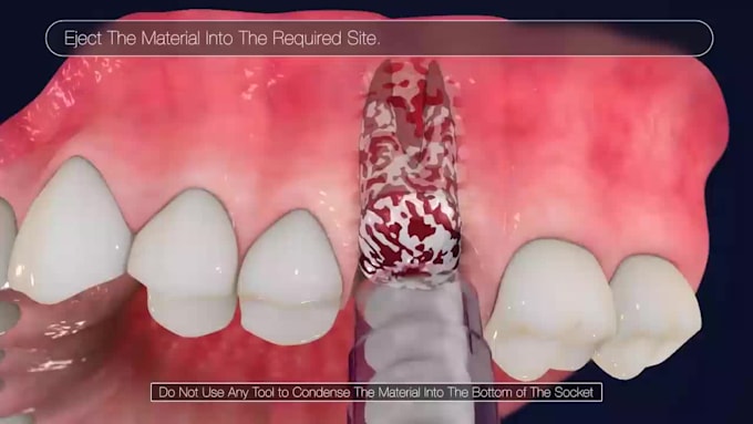 Create 3d medical animation, surgical animation, anatomy and biology ...