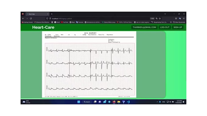 Do computer vision, deep learning, gans, and cnn based project by Dmnsangeeth | Fiverr