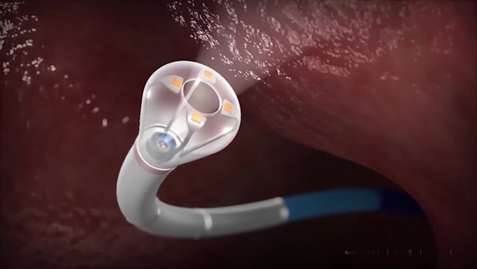 Design medical product animation, industrial medical animation, 3d ...