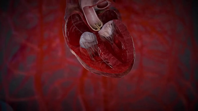 3d medical animation, explainer, surgical procedures, surgical device ...