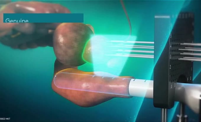 3d medical animation, 3d realistic commercial explainer animation for ...