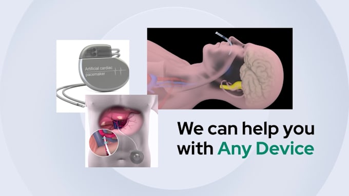 Create 3d medical animations for medical device by Jovanilov | Fiverr