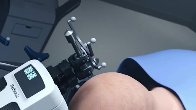 3d medical animation 2d 3d explainer scientific surgical biomedical animation by Peterjames536 ...