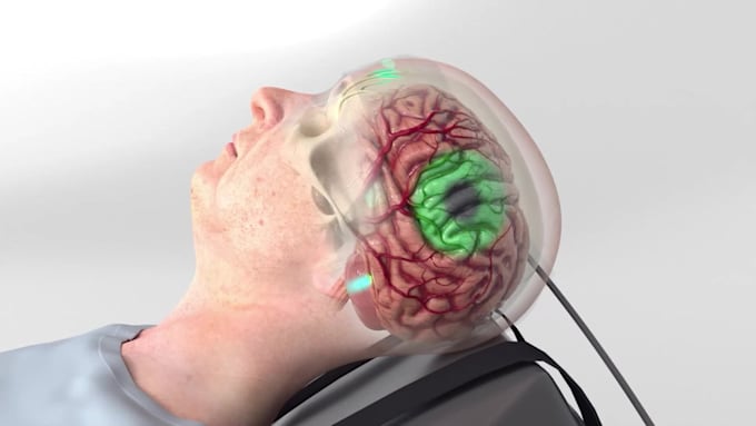 Create 3d medical animation and 3d modeling by Pariaamin | Fiverr