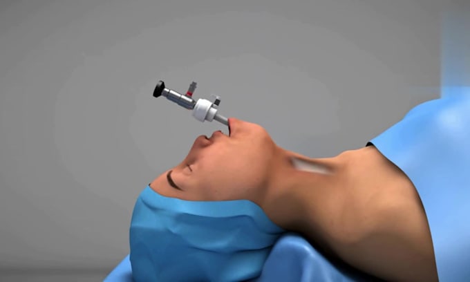 Do 3d medical animation, surgery modeling, dental animation, surgery ...