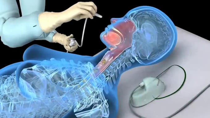3d surgery animation, anatomic medical animation, 3d children animation ...