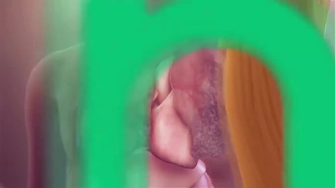 3d medical animation 3d surgery anatomy 3d moa device 3d explainer video biotech by Marcento ...