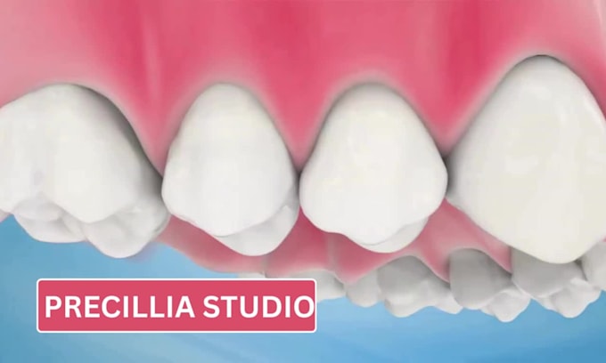 animation teeth surgery