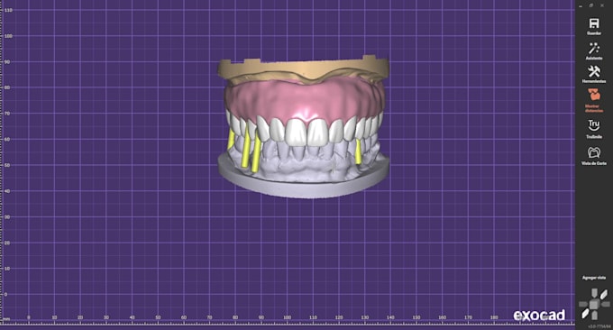 Design dental restorations on exocad, zirkonzahn by Rodrisolari | Fiverr