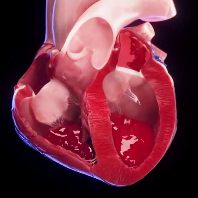 3d medical animation 3d medical explainer video 3d surgery procedure ...