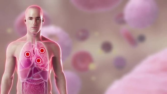 Create 3d medical anatomy illustrations and animations by Silverway ...