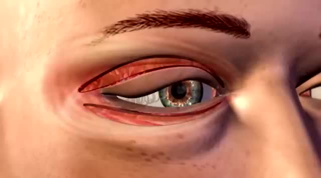 Create high quality 3d medical and surgery animation for 3d animation ...