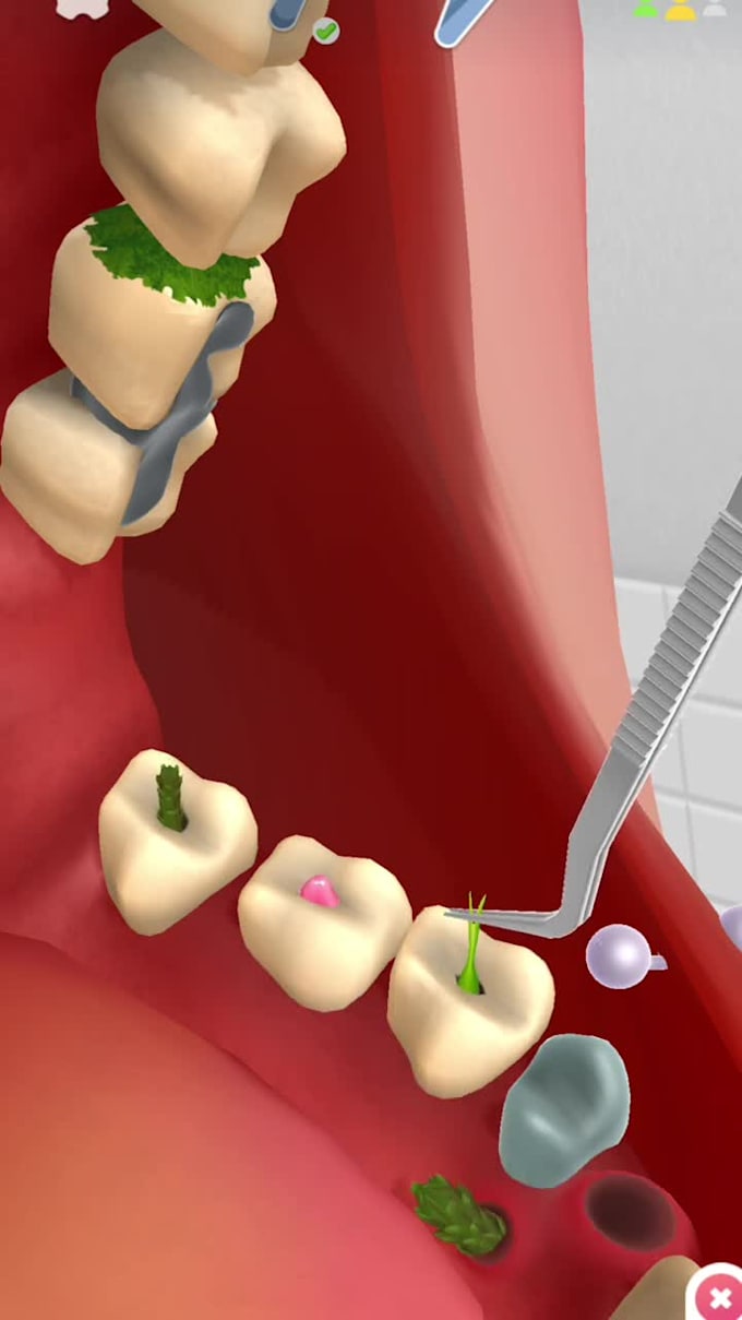 Create 3d animation, medical animation, surgery, medical, 3d medical ...