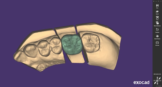 3d dental designing, full anatomic crowns by Crownology_alan | Fiverr
