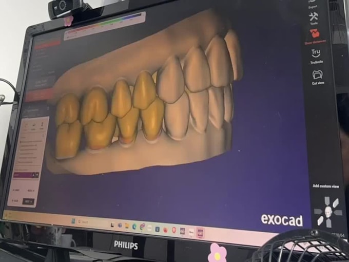 Design your case in exocad by Zeinne08 | Fiverr