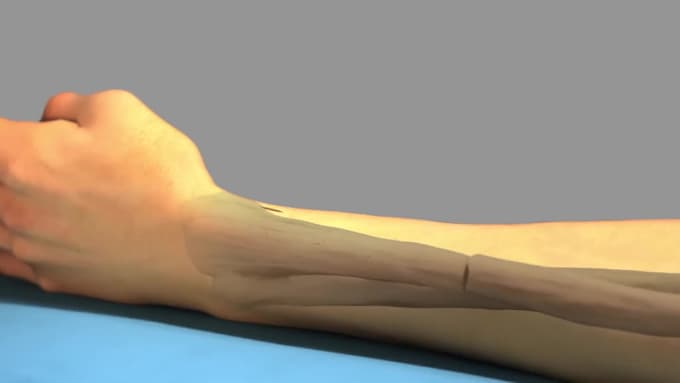 Create high quality 3d medical animation, surgery animation in hd ...