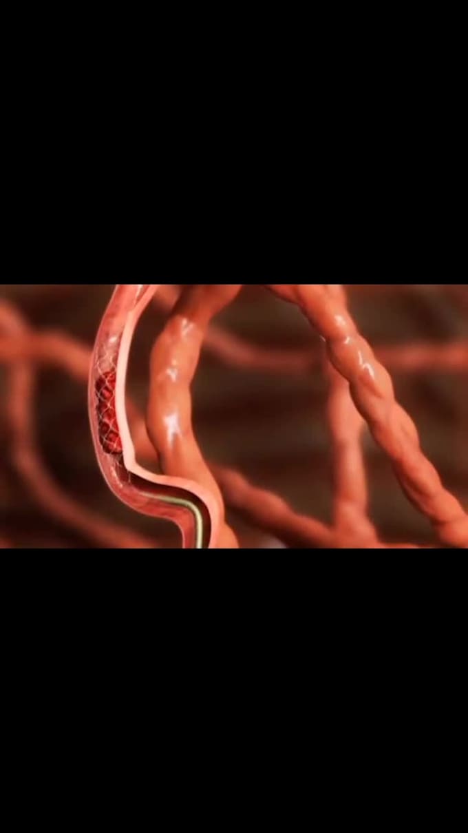 Create quality eye catching 2d medical animation explainer healthcare ...