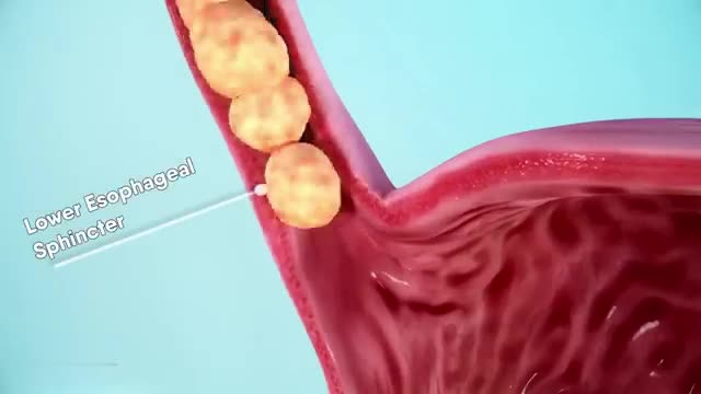 Create aesthetic 3d health anatomy, 3d surgery animation, 3d medical ...