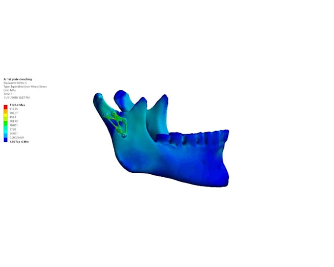 Finite element analysis or superimpose ct xrays or mri scans by ...