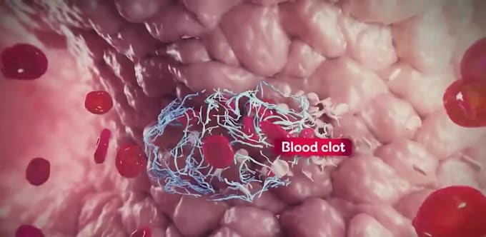 Create quality 3d 2d medical animation, surgical animation, medical ...