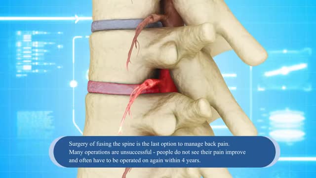 Create realistic 3d medical animation medical animated explainer by ...